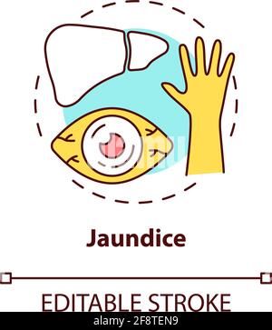 Jaundice disease vector concept illustration Stock Vector Image & Art ...