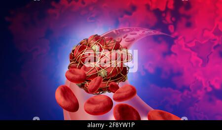 Blood clot and thrombosis medical illustration concept as a group of ...