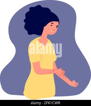 Woman scratching skin. Girl with itching elbow hand or rash on body ...