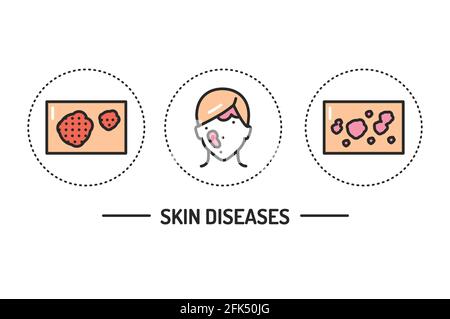 Skin diseases color line icons set. Isolated vector element. Outline ...