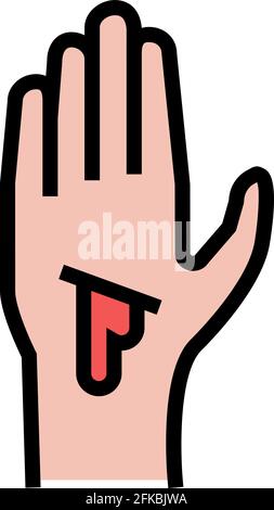 vector illustration of a Arterial and venous bleeding Stock Vector ...