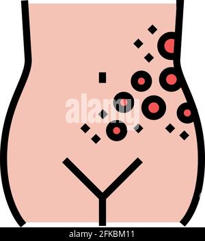 shingles skin disease line icon vector illustration Stock Vector Image ...