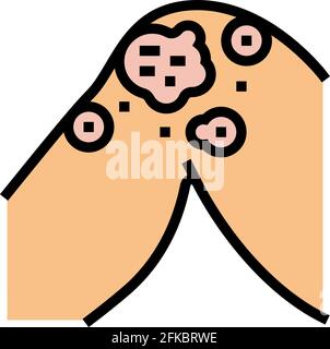 Atopic dermatitis line color icon. Sign for web page, mobile app ...