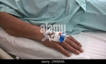 hand with peripheral intravenous cannulas or catheters Stock Photo - Alamy