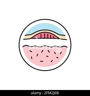 Bruise color line icon. Dermatology disease. Isolated vector element ...