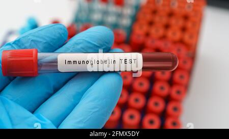 Immunoglobulin G Test tube with blood sample in infection lab Stock ...