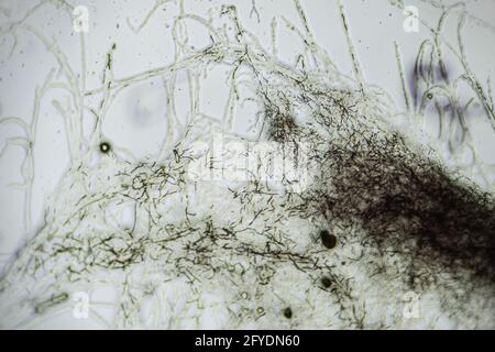 Kombucha tea macro close up under the light microscope, magnification ...