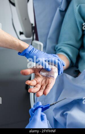 Application of a QUTENZA skin patch based on Capsaicin (an extract of ...
