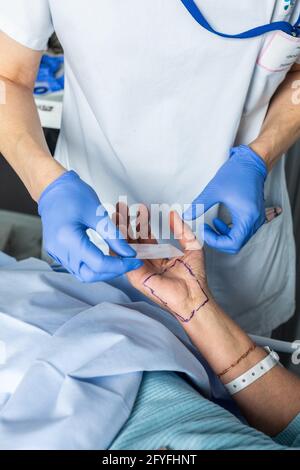 Application of a QUTENZA skin patch based on Capsaicin (an extract of ...