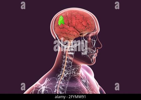 Brain with highlighted supramarginal gyrus, illustration Stock Photo ...