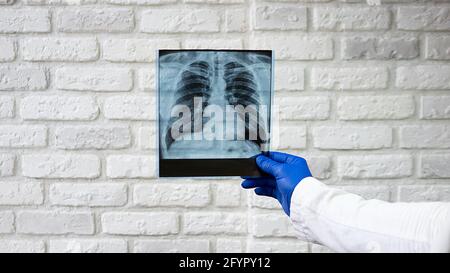 X-ray of human lungs. The doctor diagnoses the patient. Chest X-ray ...