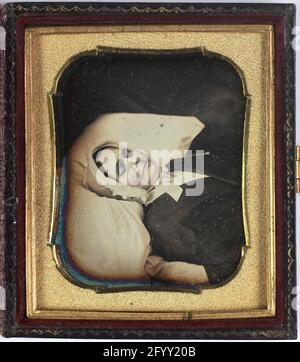 Post-mortem from a woman Stock Photo - Alamy