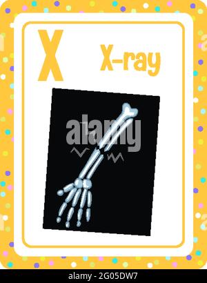 Alphabet flashcard with letter X for X-ray illustration Stock Vector ...