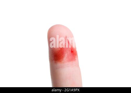 human finger with a cut a consequence of skin damage and open bleeding ...