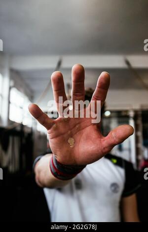 Athlete man's hands after intense training Stock Photo - Alamy