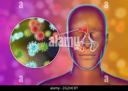 Human parainfluenza virus, illustration Stock Photo - Alamy