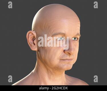 Man without hair, illustration Stock Photo - Alamy