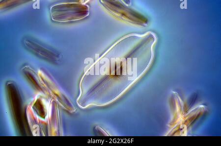 Diatom, photomicrograph, darkfield illumination Stock Photo - Alamy