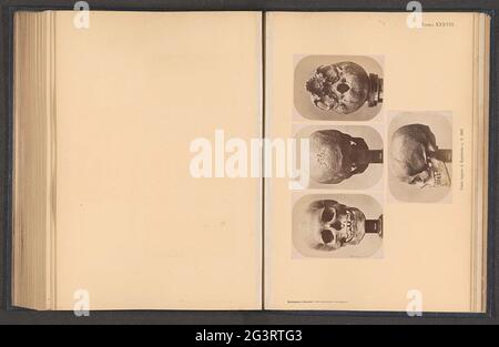 Four images of a Samic men's skull, c. 1870 - in or before 1880 At the ...