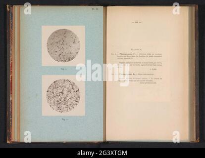 Two microscope shots of cholera Stock Photo - Alamy