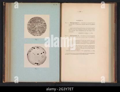Two microscope shots of cholera Stock Photo - Alamy