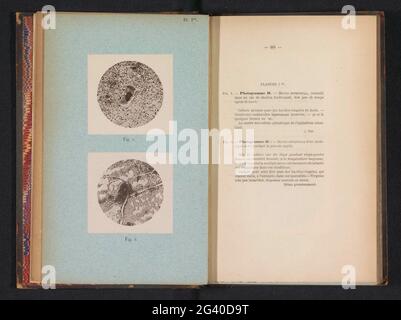 Two microscope shots of cholera Stock Photo - Alamy