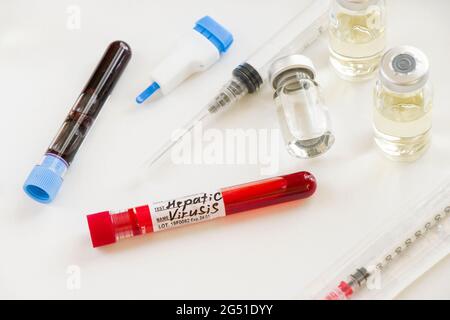 Closeup shot of a Hepatitis C blood test sample on a diagnostic lab ...