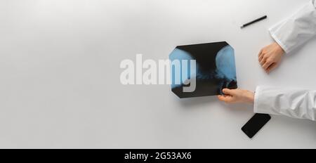 the doctor hands holdong the human body xray scan and examine the bones ...