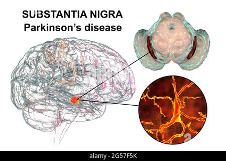 Substantia nigra in the human brain, illustration Stock Photo - Alamy