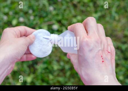wounds on the skin cat scratches. skin with wounds.irritated skin.care ...