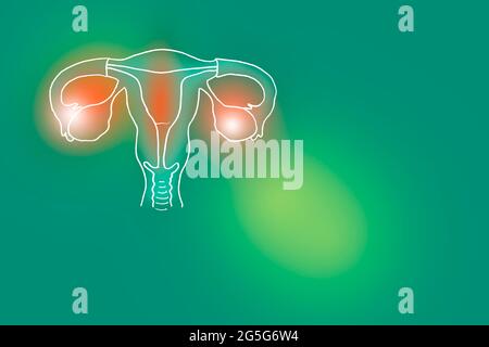 Uterine cervix, drawing Stock Photo - Alamy