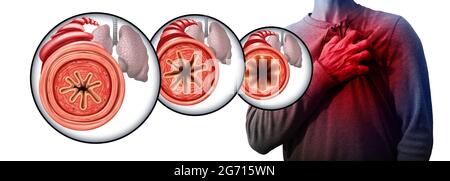 Asthma bronchial tube constricted breathing problem concept caused by ...
