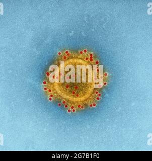 Transmission electron microscope image of an influenza A H5N1/bird flu ...