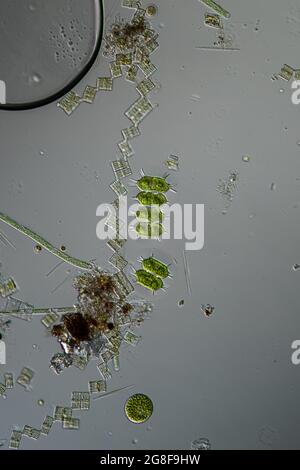 Green algae under the microscope 100x Stock Photo - Alamy