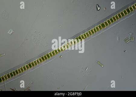 Green algae under the microscope 100x Stock Photo - Alamy