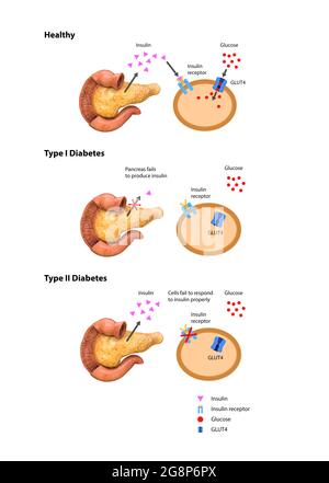 mechanism of action of insulin, glucose, Human Insulin, structure of ...