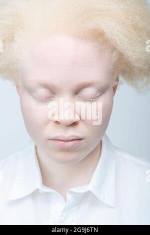 Studio portrait of albino woman Stock Photo - Alamy