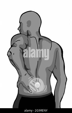 Back pain drawing Stock Photo - Alamy
