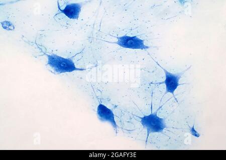 Light micrograph of human brain tissue showing neurons and glial cells ...