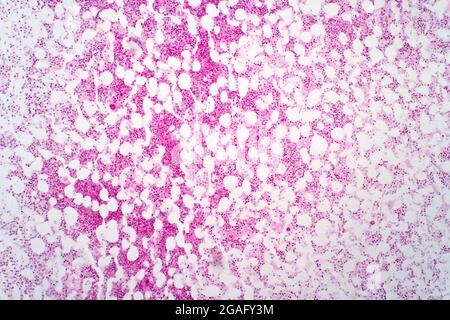 Light micrograph of human bone marrow which fills the intertrabecular ...