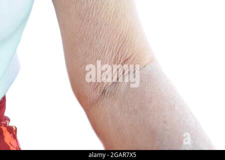 Aging skin folds or skin creases or wrinkles at neck of Southeast Asian ...