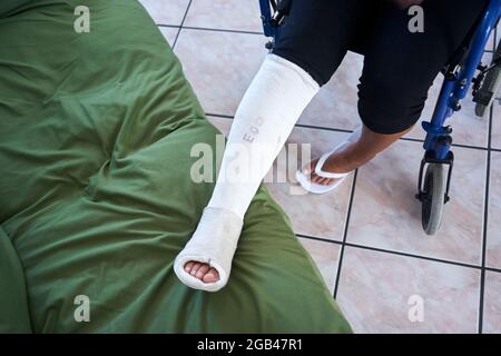 White plaster and fiberglass leg cast worn by a young man(isolated on ...