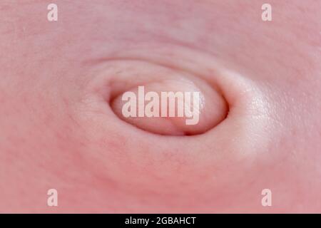 newborn baby belly button healing after birth, navel of little baby ...