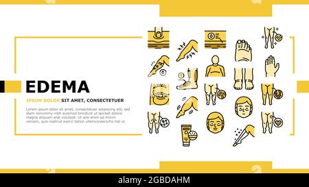 Varicose vein disease symptom, treatment medical infographic Stock ...