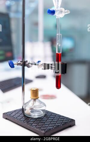 Blood sample ready for biological examination during microbiology ...