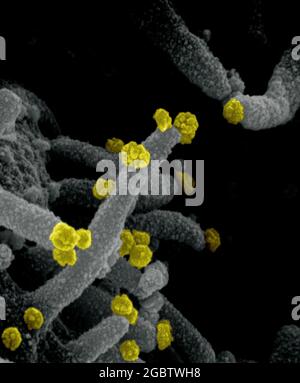 transmission electron microscope image of yellow fever virus Stock ...