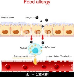 Food allergy. abnormal immune response to food. Reaction of immune ...