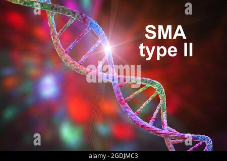 Spinal muscular atrophy, illustration Stock Photo - Alamy