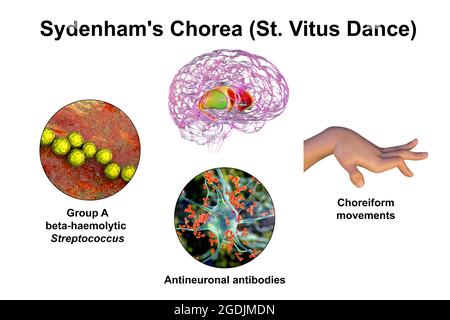 Dorsal striatum, illustration Stock Photo - Alamy