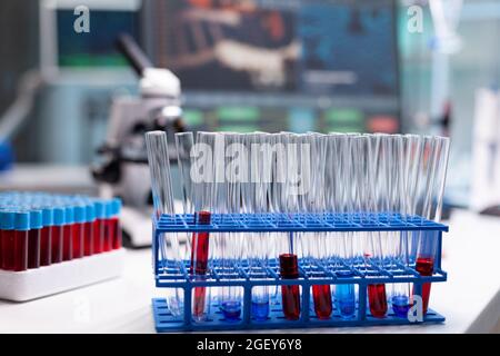 Blood sample ready for biological examination during microbiology ...